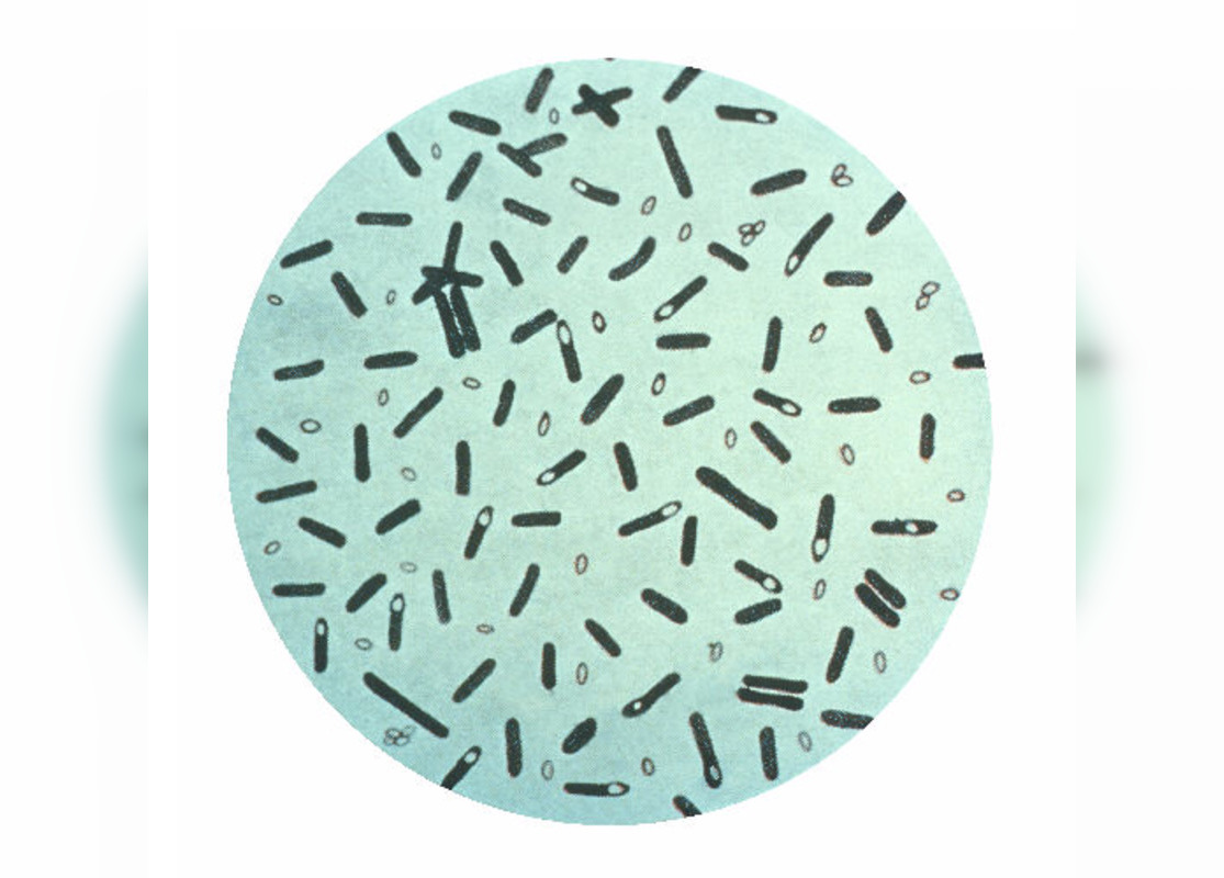 Anniversary of Peoria's Infamous Botulism Outbreak Sheds Light on