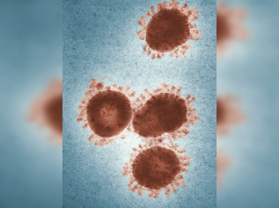 Alaska Reports First Death from Alaskapox Virus as Kenai Peninsula Man