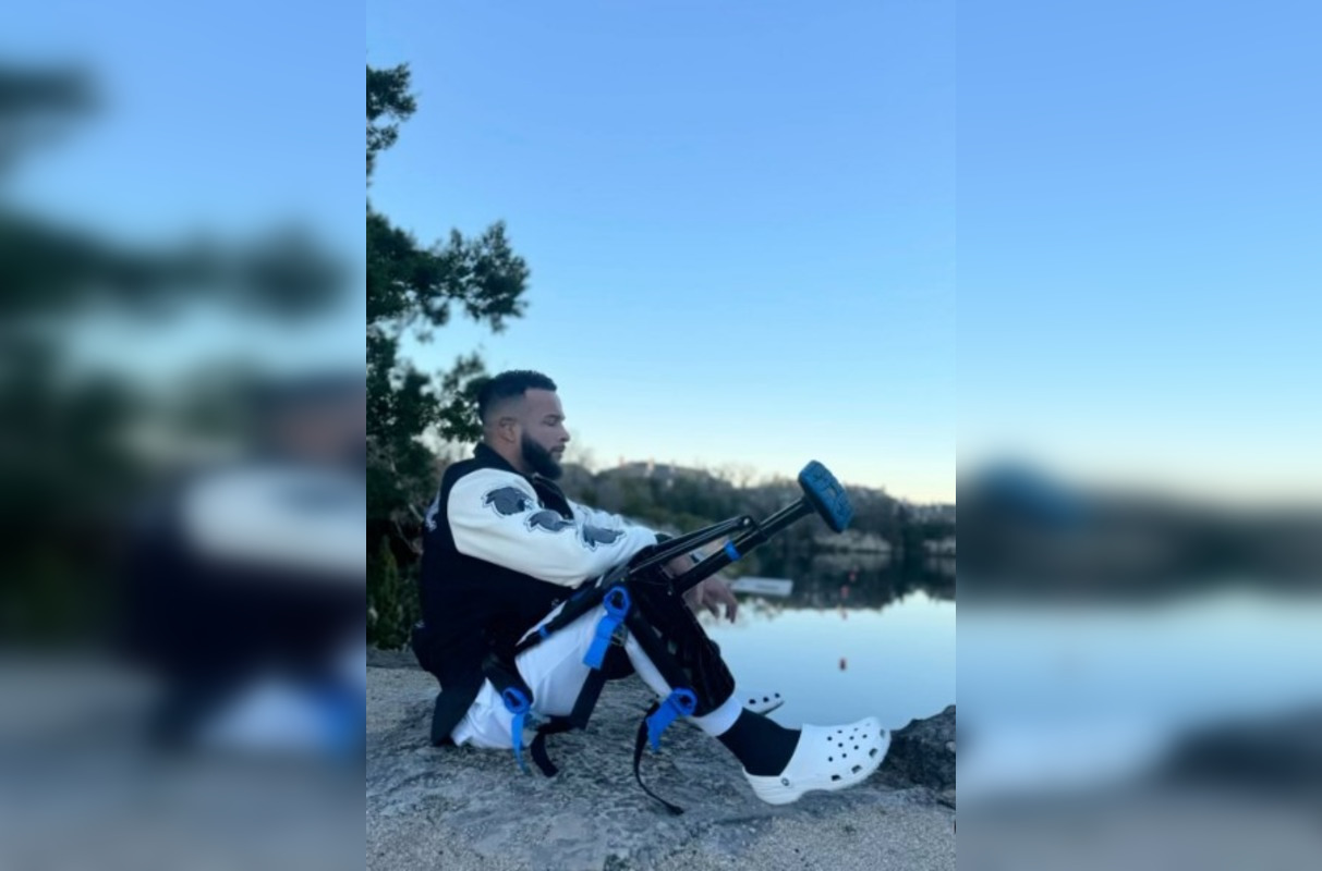 "The Challenge" Star Nelson Thomas Faces Leg Amputation Following DUI