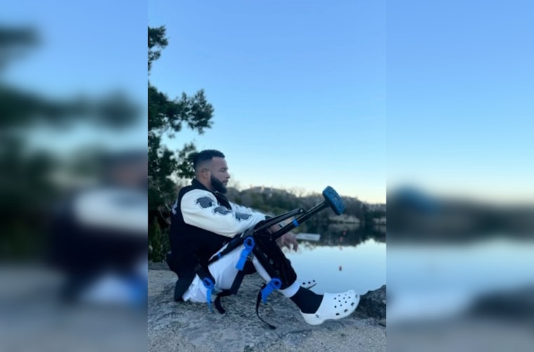 "The Challenge" Star Nelson Thomas Faces Leg Amputation Following DUI