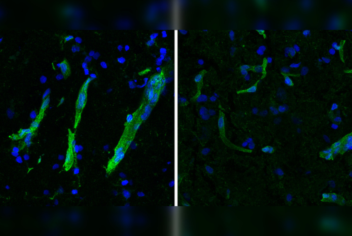 MIT and Mayo Clinic Study Reveals Potential Unified Treatment Path for