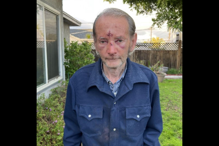 San Diego Police Seek Public's Help to Locate Missing 73-Year-Old Evan