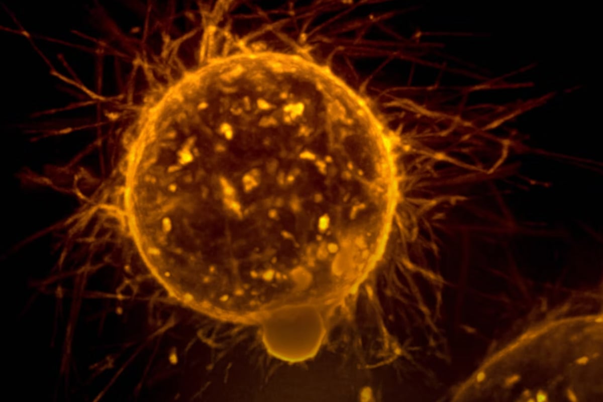 MIT and Harvard Medics Unleash Revolutionary CAR-NK Cells to Battle