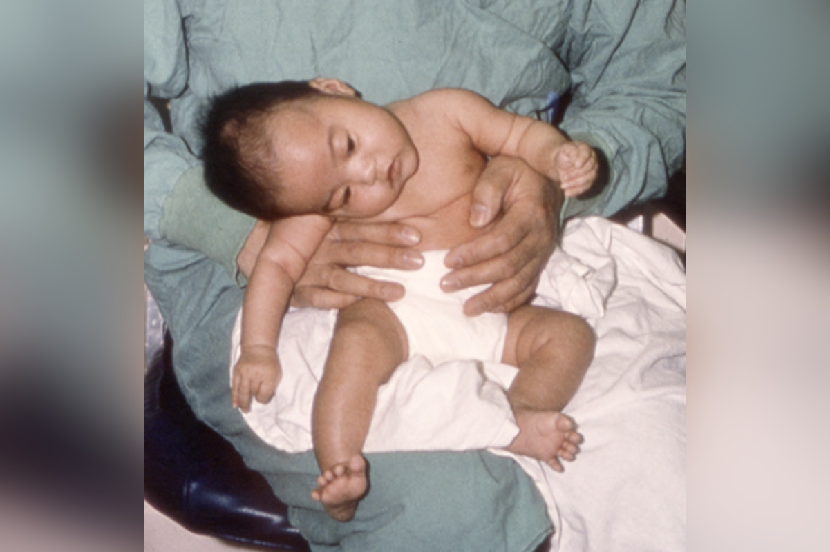 Nationwide Alert! FDA Orders ByHeart Infant Formula Recall After