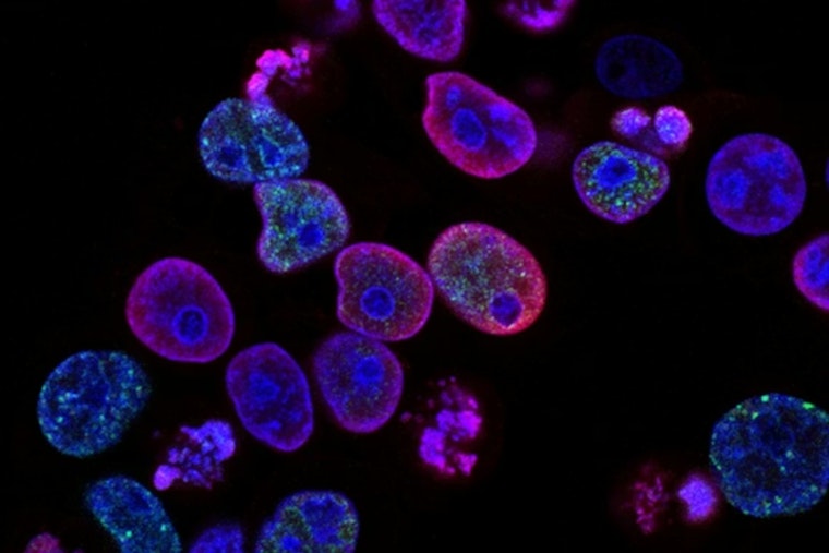 Dallas Lab Nails Culprit Protein Behind Explosive Cell Death