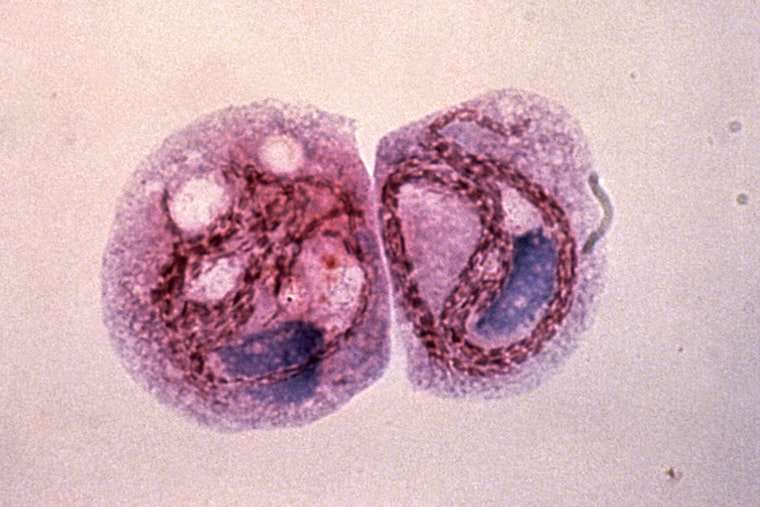 Fourth Death in Central Harlem Legionnaires’ Outbreak as Cases Hit 99