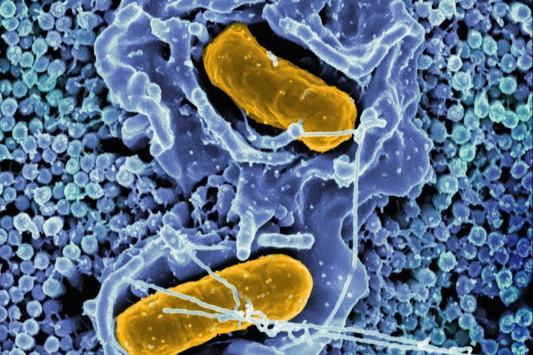 CDC Issues Warning to Discard Certain "Metabolic Meals" Amid