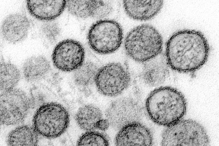 UT Austin Lab Cracks Deadly Virus Map, Puts Hantavirus Vaccine In