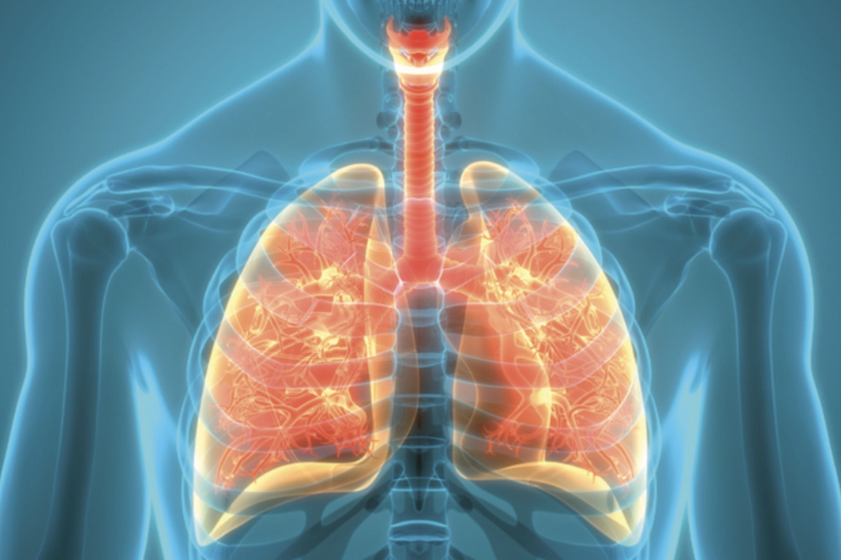 Houston Tops Texas TB Rates, County Report Shows