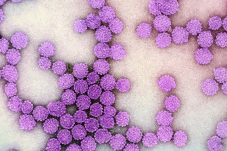 Bepirovirsen Shows Promise As Functional Cure For Hepatitis B